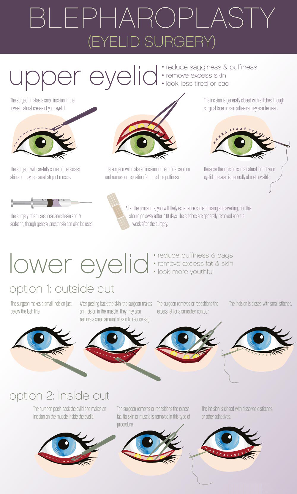 How Blepharoplasty(Eyelid Surgery) is Performed [Infographic]